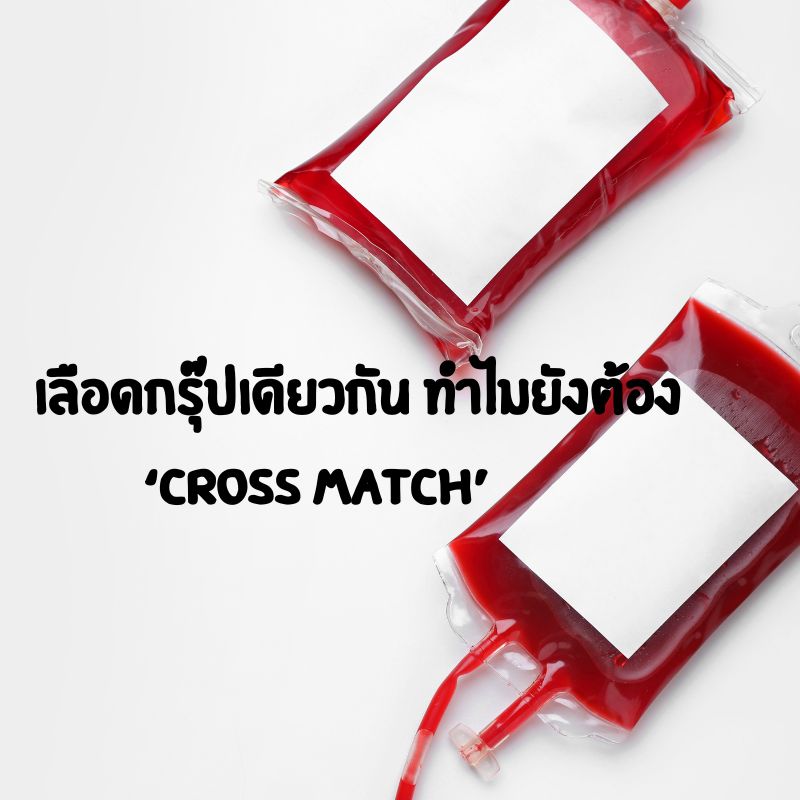  Cross Match Pakkretpet